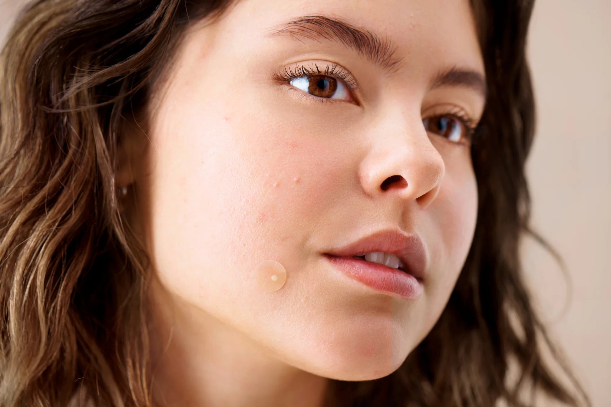 Pimples, Explained: How to Identify and Treat Every Type of Acne – Test ...